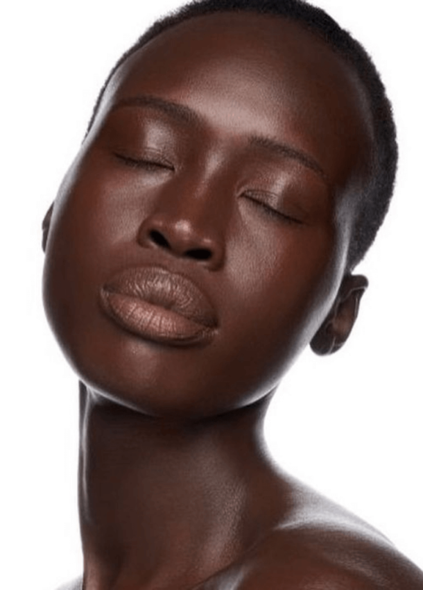 Pele Negra: Saiba como cuidar e quais são as características