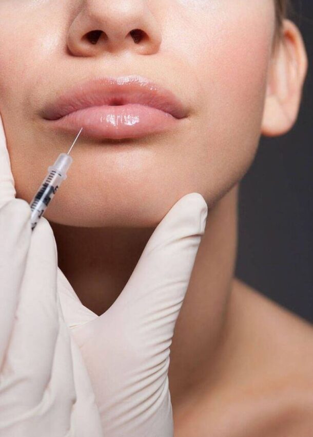 Botox: Esclareça as principais dúvidas